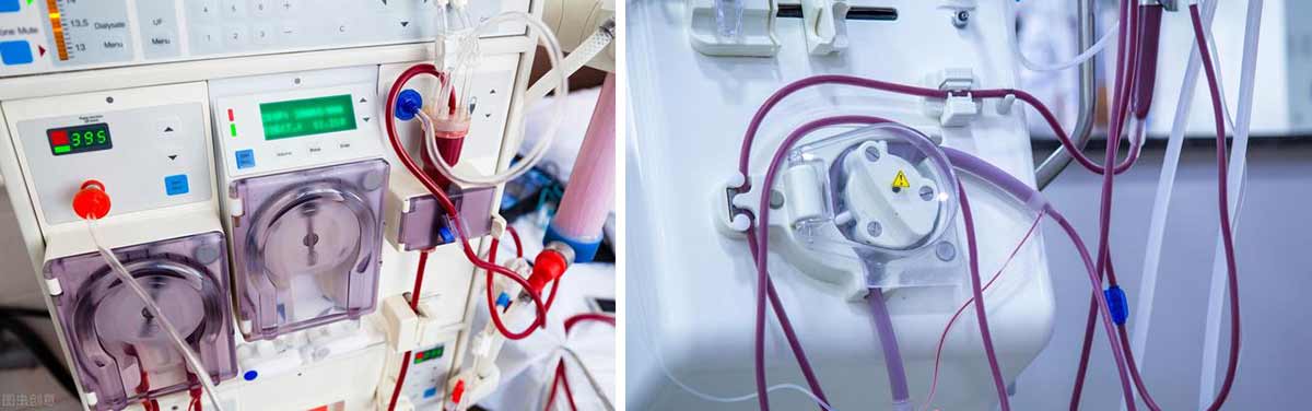 How to Give Heparin During Dialysis? - HPP LINES
