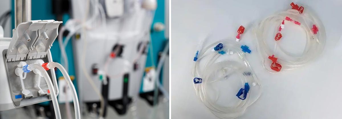 What Is Normal Blood Pressure for Dialysis Patients? - HPP LINES