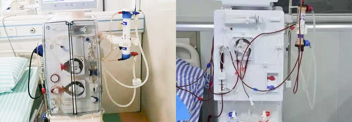 What Is Diffusion in Dialysis? - HPP LINES