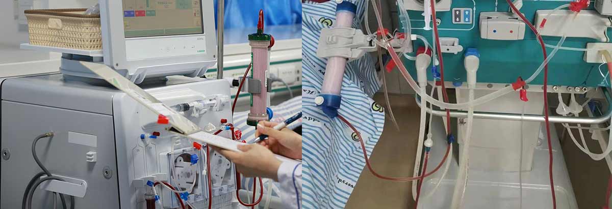 A Guide to Dialysis Machines and Their Specific Uses - HPP LINES