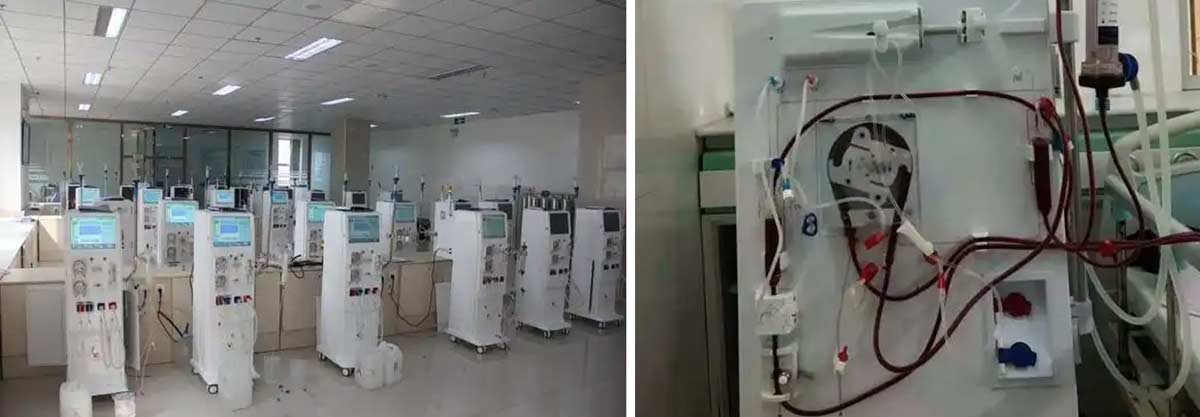 Step by Step Guide to Setting Up a Dialysis Machine - HPP LINES